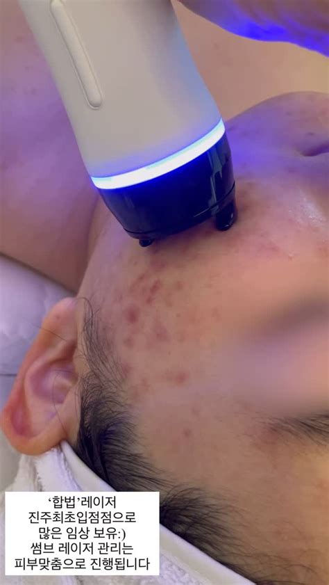 썸머브리즈 • 진주에스테틱 •문제성피부 •윤곽리프팅 •신부관리 •다이어트 뜯어내면 물광이 차르르 필링의 새로운 패러다임 썸브 인기관리 탕후루필의 계절이 돌아왔습니다