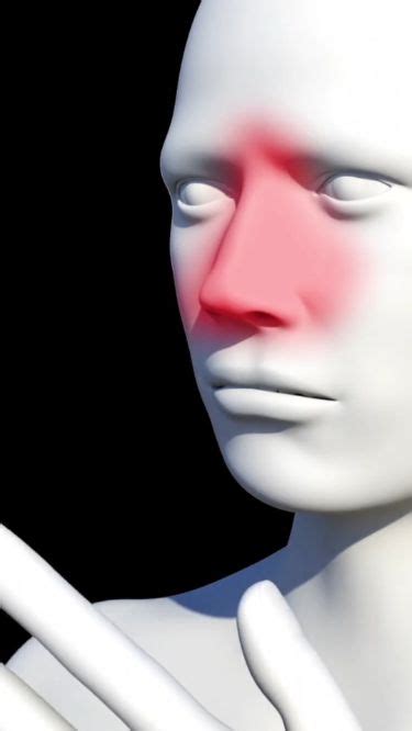 A Sinus Infection May Be The Cause Of A Toothache In 2025 Dental Fun Facts Dental Images