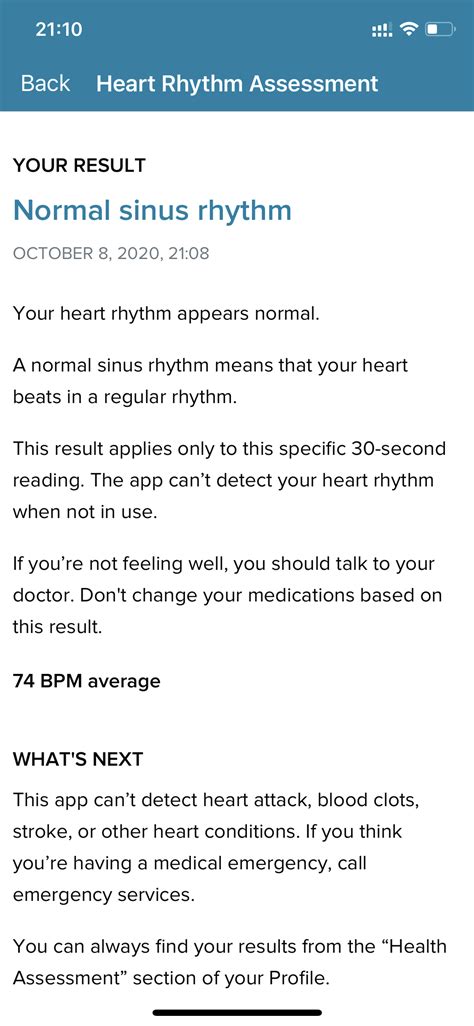 Fitbit Activates The Ecg App On The Sense Smartwatch Softpedia