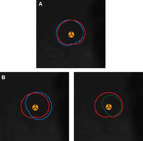 Multiple Independent Current Source Versus Single Current Source Download Scientific Diagram