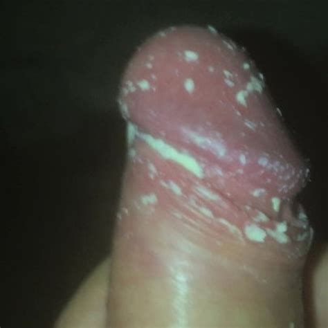 Unwashed Cheese Smegma Dick Gay Porn Xxx Porn 41 Xhamster Xhamster