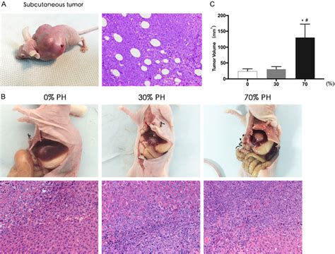 Figure 1 From Partial Hepatectomy Promotes Implanted Mouse Hepatic