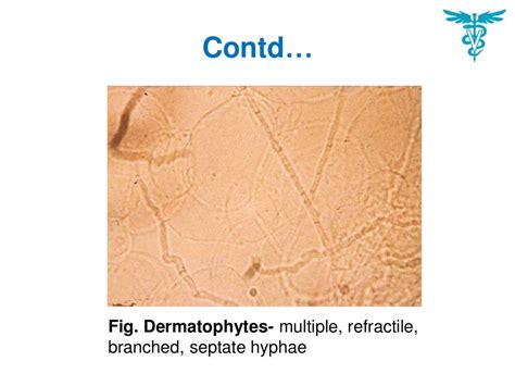 Skin Scraping Test