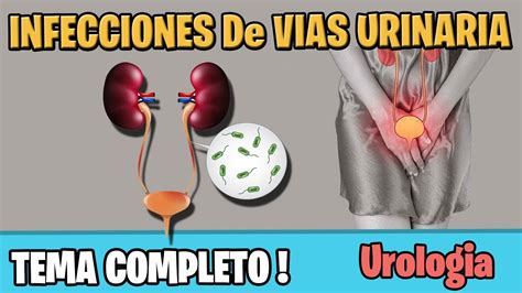 Qué Es Una Infección Urinaria Infección De Las Vías Urinarias Ogew