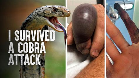 How To React During A King Cobra Attack Life Saving Tips
