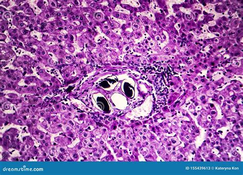Schistosoma Mansoni Parasites Under The Microscope Stock Image