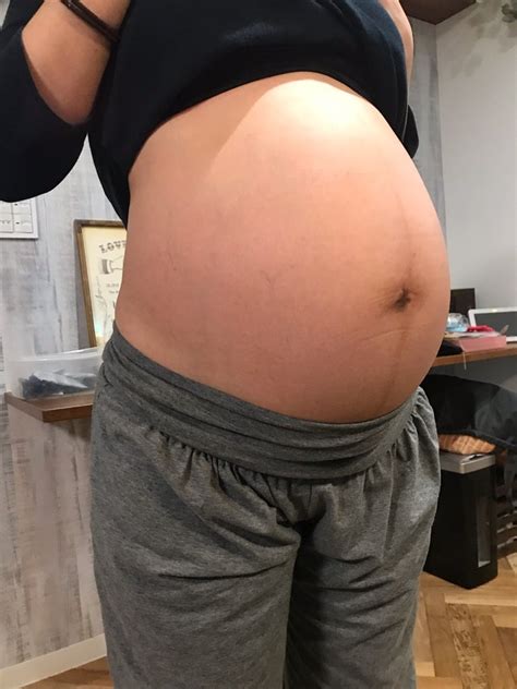 産後の体 見た目編 妊娠中のお腹の写真あり お気楽ブログ
