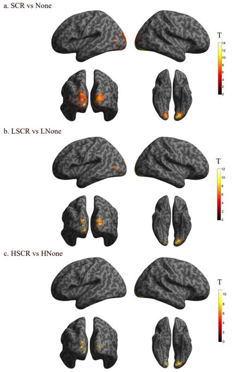 multivariate pattern analysis results of the attentional load