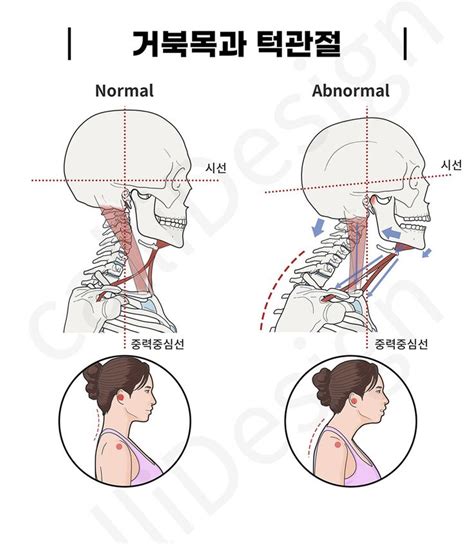 Pin Op 해부학 그림