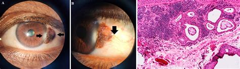 Ankit Gupta Sachin Daigavane