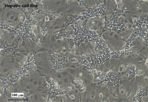 Light Transmission Micrography Of A Hepatic Cell Line Culture The Cell Download Scientific