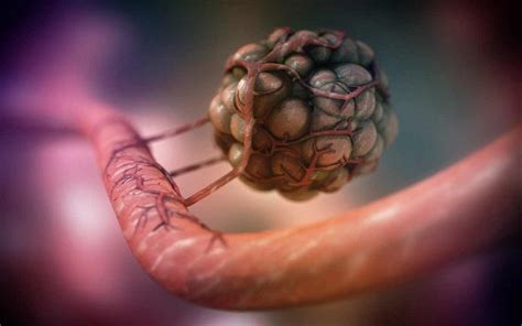 Признаки рака на ранних стадиях