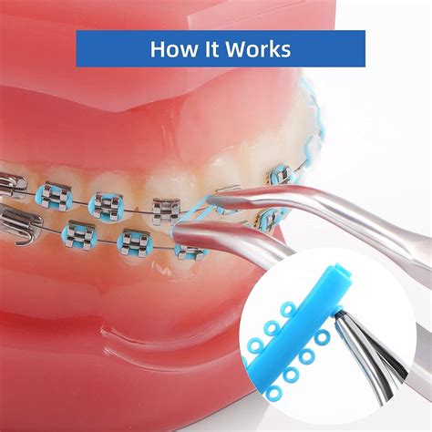 Orthodontic Ligature Ties Braces Color Bands 1040 Pcs Annhua Dental