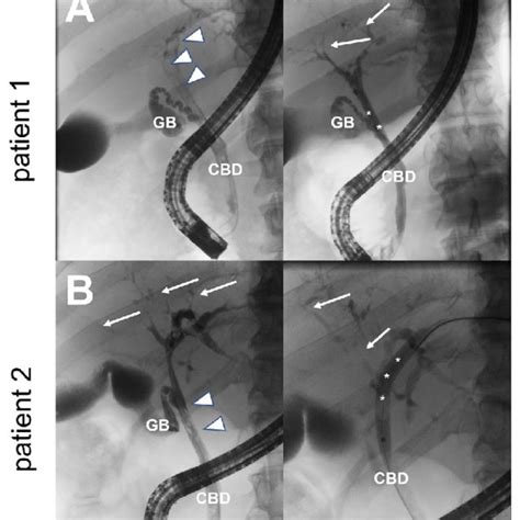 ERC Of Patient A Top And Patient B Bottom And Days Download Scientific Diagram
