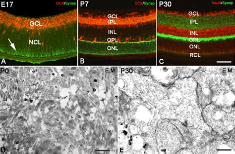 Synaptogenesis In Retina A At E17 Synaptophysin Synap Green Download Scientific Diagram