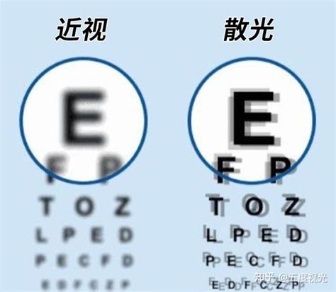散光是什么它对我们的眼睛究竟有没有危害 知乎