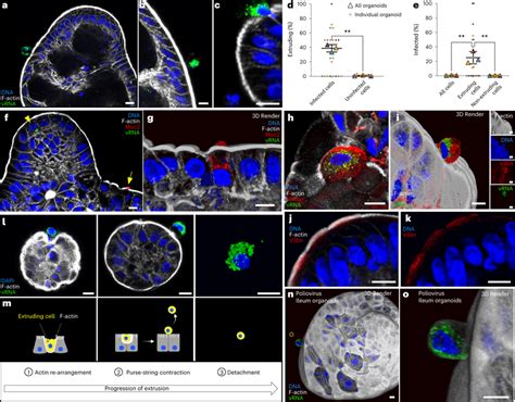Specific Extrusion Of Ev A71 Infected Cells From Colonoids A C Download Scientific Diagram