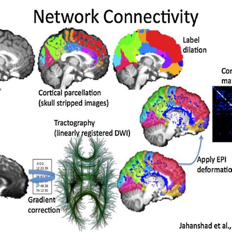 Of Age Effects On Structural And Functional Connectivity In Subjects Download Scientific