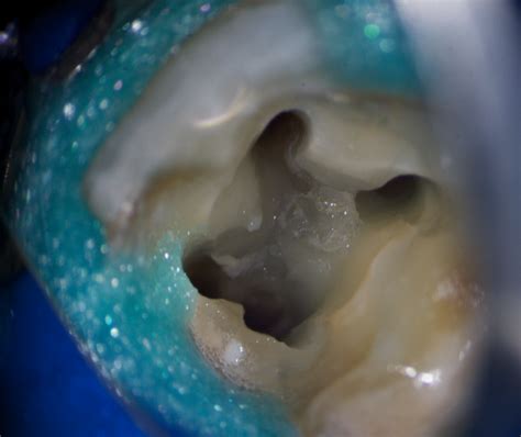 Tecnología Empleada Microscopio Y Los Sistemas Más Avanzados De