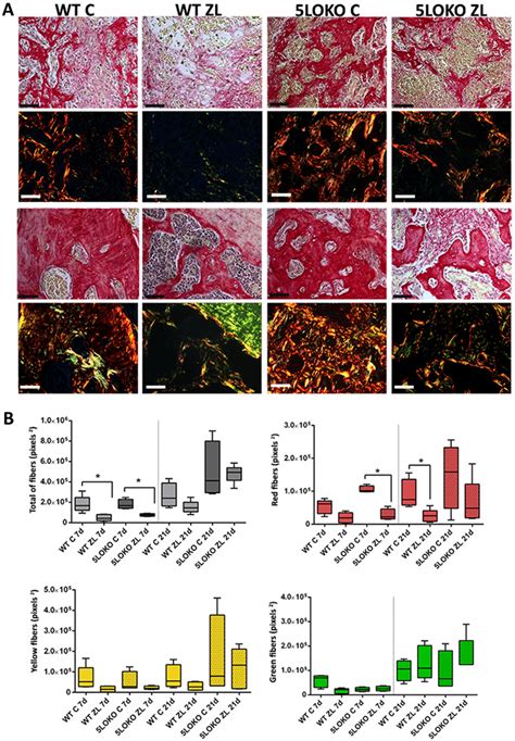 Birefringence Analysis Of Collagen Fibers In Alveolar Sockets Post Download Scientific Diagram