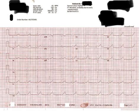 Pre Op Ekg Post Op Chestback Discomfort Raskcardiology