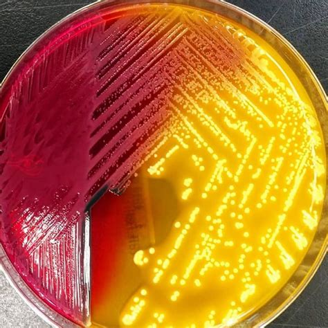 Xld Agar Shigella