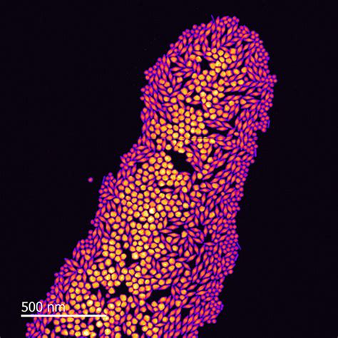 Interviews09super High Precision Imaging High Spatial And Energy Resolution Spectroscopy And
