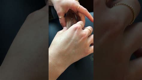 Goniometry Thumb Cmc Flexion And Extension Abduction Opposition Youtube