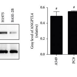 ANGPTL4 Expression In A549 PC9 BEAS 2B And PC9 GR Cells Xs