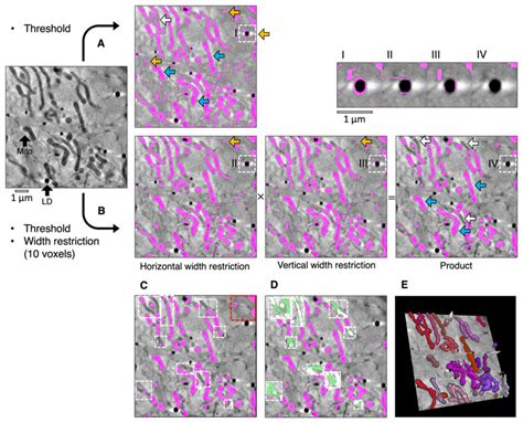 Semi Automated Segmentation By Analysing The Intensity And Width Of