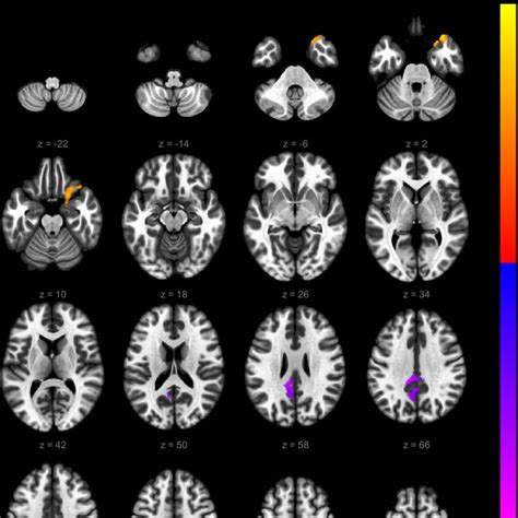 The Connectome Representing Resting‐state Functional Brain Connectivity Download Scientific