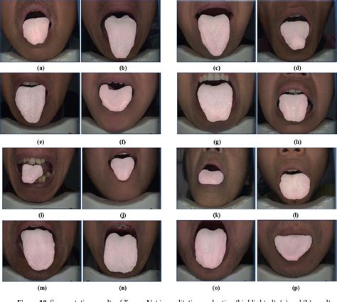 Figure 1 From Tonguenet A Precise And Fast Tongue Segmentation System