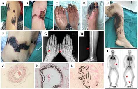 Clinical Manifestations Imaging Features And Histopathology Of Download Scientific Diagram