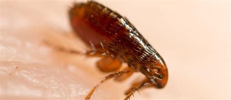Can Fleas Live On Human Hair