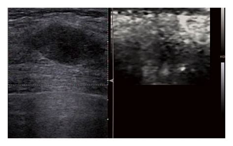 Images Of The VTI Patterns 14 A VTI Right Shows A Bright Area Download Scientific Diagram