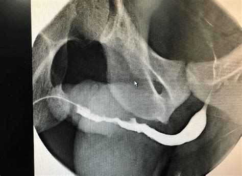 Ascending Urethrogram Download Scientific Diagram