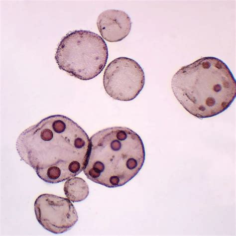Volvox Asexual Stages Slide Wm Carolina Biological Supply