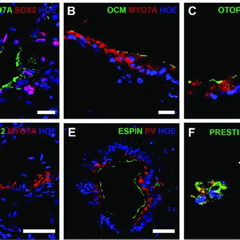 Immunohistological Analysis Of Cochlear And Vestibular Hair Cell