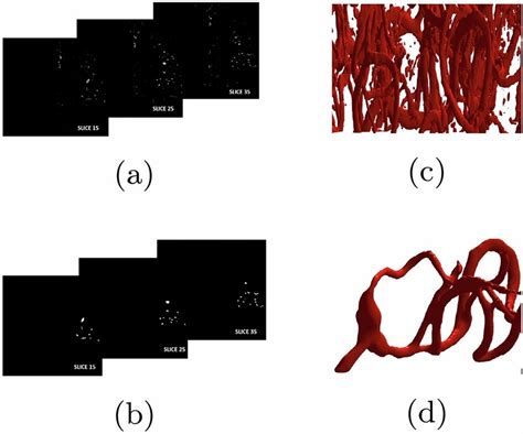 Three Slices From Dataset 1 A Before Segmentation B After Download Scientific Diagram