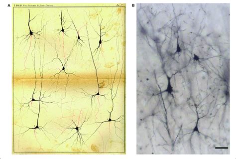 Drawing A And Images B Of Golgi Impregnated Neurons Of The Download Scientific Diagram