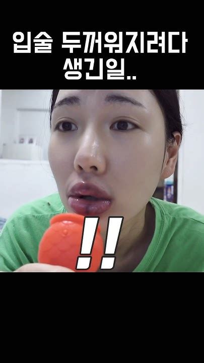 입술 두꺼워지려다 생긴 대참사… Youtube
