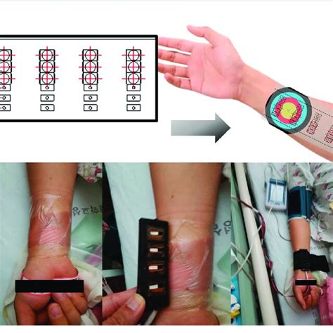 A Schematic Diagram Of Functional Near Infrared Spectroscopy Fnirs Download Scientific