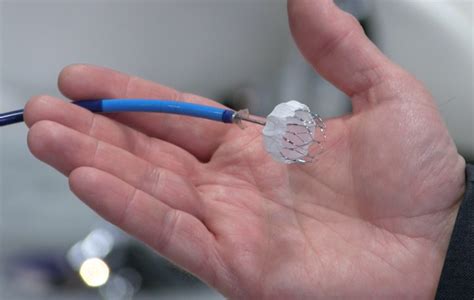 Watchman Procedure A Cardiac Patients Guide Longmore Clinic