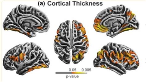 Being Choked During Sex Just A Handful Of Times Could Lead To Permanent Brain Damage Alarming