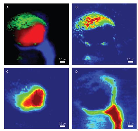 拉曼光谱学在生殖医学中的应用