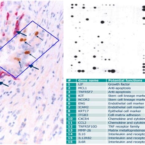Gene Expression Profiling Of Cells Overlying Focally Disrupted And Download Scientific Diagram
