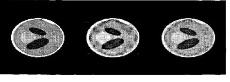 Figure 2 From A New Interpolation Technique For Orthogonal Sets Of Tomographic Medical Images