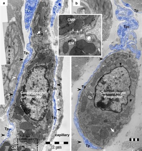 Telocyte Cardiomyocyte Progenitors Cmp A B Electron Microscopy