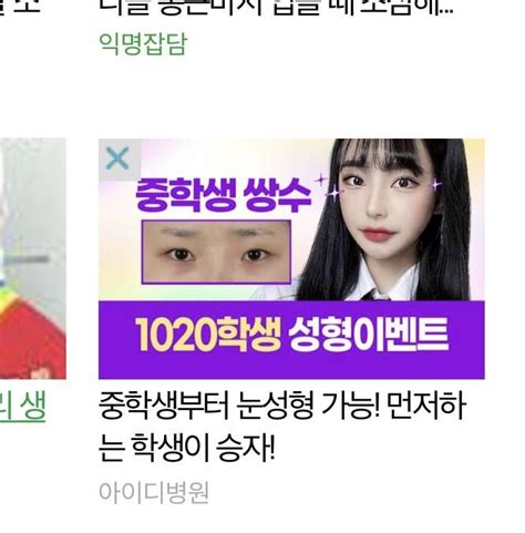 요즘 정신나간 성형광고들 많네 인스티즈 Instiz 익명잡담 카테고리