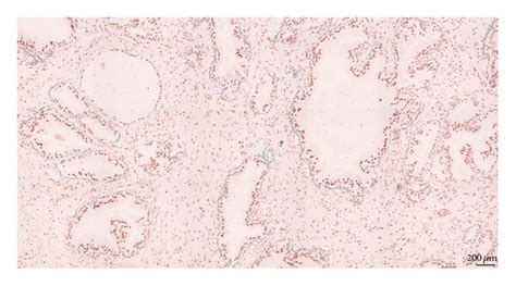 Larger Scan Areas 24x 400x Utilized For Segmentation And Binarisation